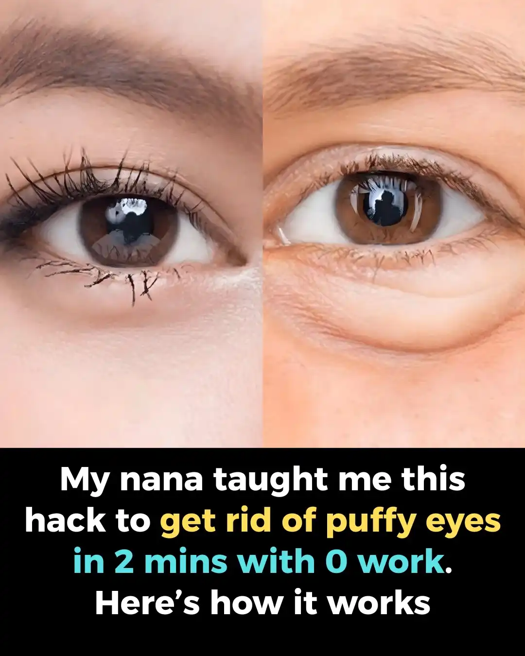 🥔 My Nana’s 2-Minute Trick to Get Rid of Puffy Eyes (No Work Needed ...