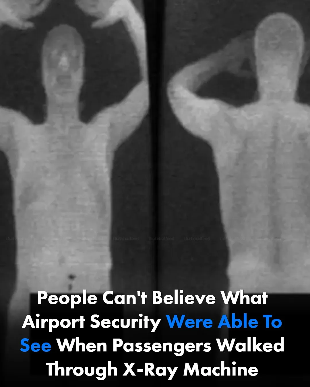 People Shocked To Learn What Airport Security Used To See Through Old X ...