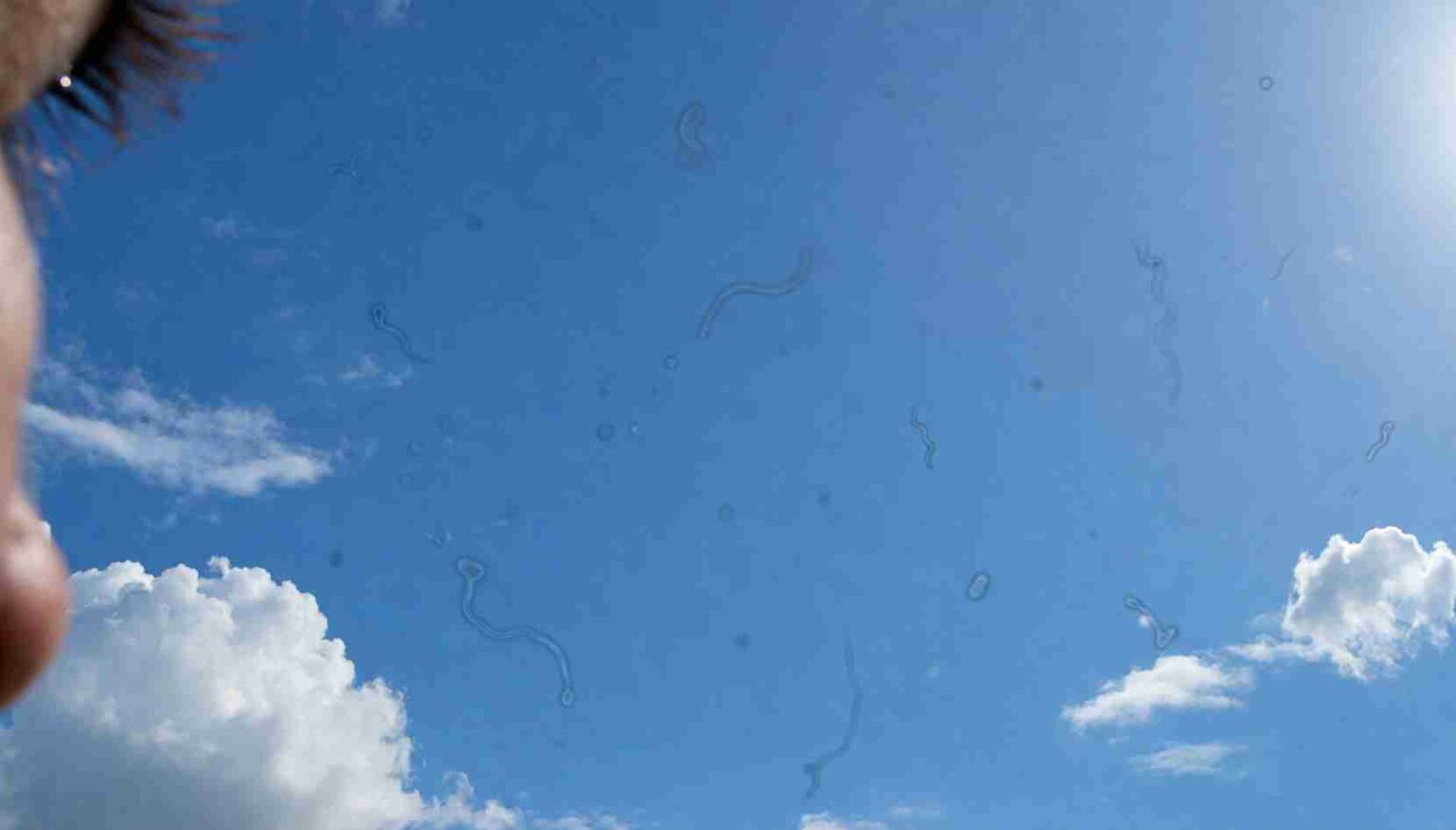 Eye floaters: what they are and what to do if you notice them,